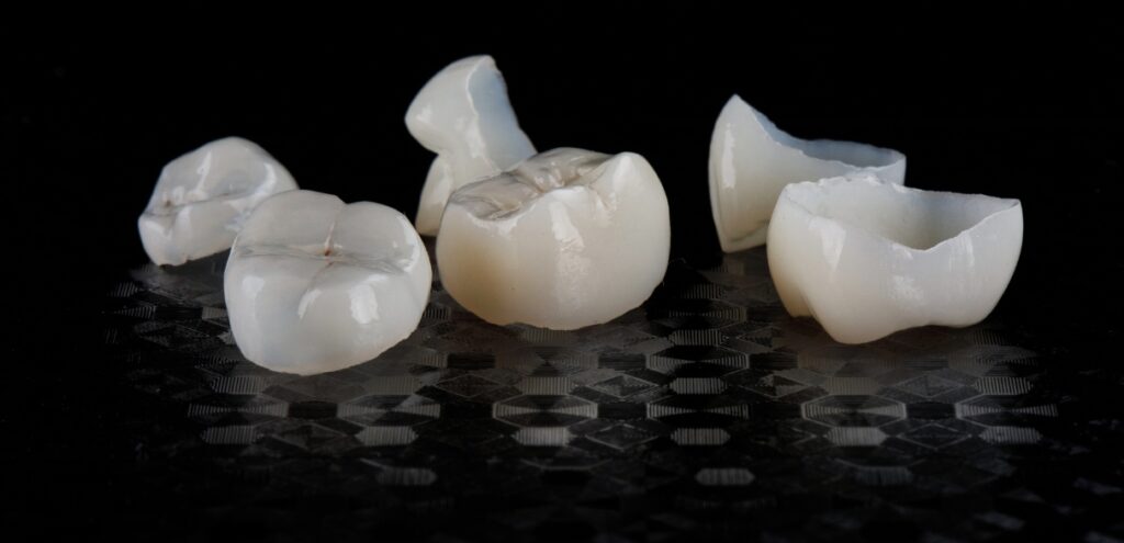What are the pros and cons of porcelain crowns