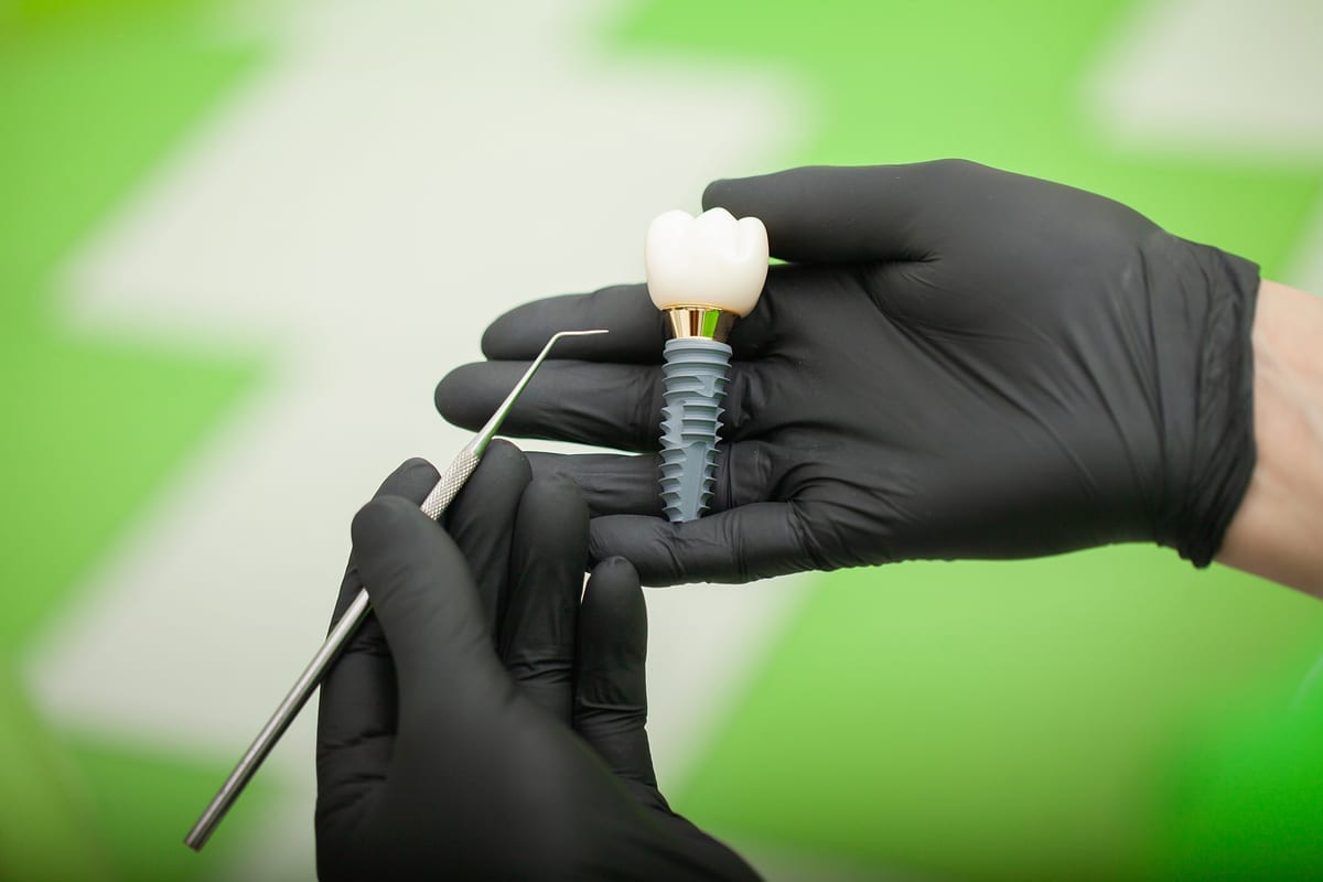 Dental Implants in Chatsworth, CA | Chatsworth Family Dental Group ...